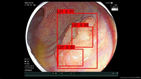Pytorch Mask Rcnn训练自己的数据集 Pytorch Ssd训练自己的数据集mob64ca140651e5的技术博客51cto博客