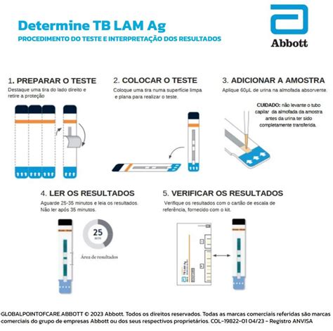 Coinfecção Tb Hiv Já Ouviu Falar Do Teste Rápido Lf Lam Blog