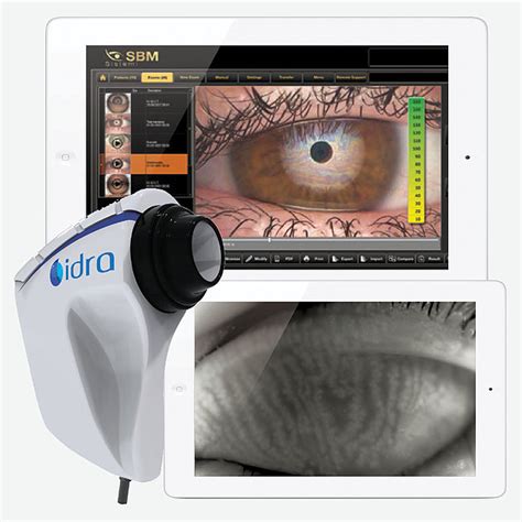 Grafton Optical Is Pleased To Announce The Launch Of The Idra Ocular Surface Analyser At 100