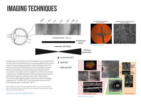 Shallow Introduction For Deep Learning Retinal Image Analysis Pdf Eye And Vision Conditions