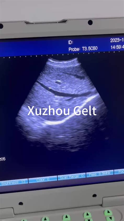 Cardiac Probe Echographe Doppler Color Doppler Portable Ultrasound Heart Diagnosis Doppler