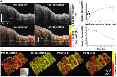 Contrast Enhanced Optical Coherence Tomography With Picomolar