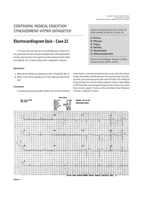 Pdf Electrocardiogram Quiz Case 22 Wandering Atrial Pacemaker