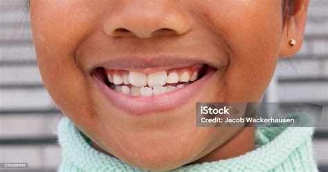 미소 건강 행복을 위한 도시에서 아이의 클로즈업 치열 교정 의사와 치아 청소 자부심 건강 및 구강 위생을 통해 야외에서 사람의 입 확대 축소를 통해 자신감 잇몸 관리 및