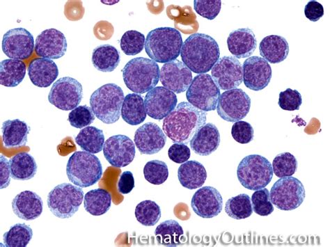 Hematologyoutlines Glossary