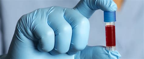 Pediatrics Analytic Interference Quidelortho Pediatrics Analytic Interference Quidelortho