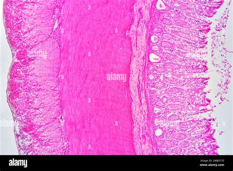 Human Vermiform Appendix Cross Section Showing Left To Right