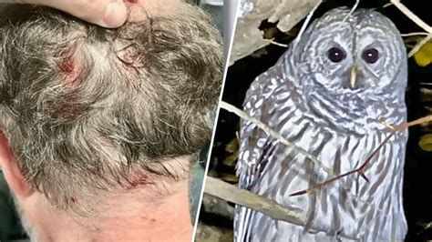 Owl Attacks Man Walking Dog In Medfield Nbc Boston