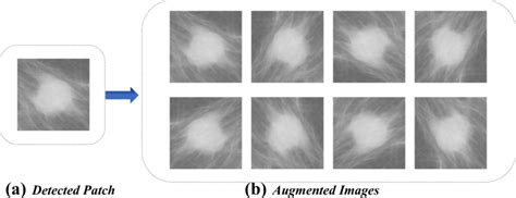 Example Of Data Augmentation Method A Detected Patch Roi B Download Scientific Diagram