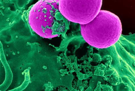 Mrsa National Geographic Society