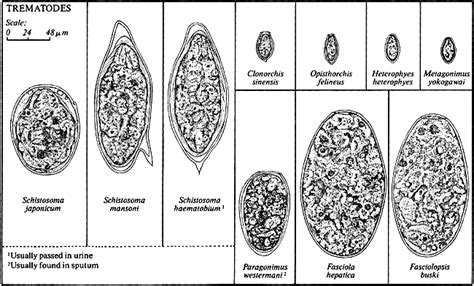Trematodes Diagnostic Parasitology
