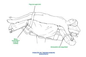Posición Quirúrgica Apuntes Auxiliar Enfermeria