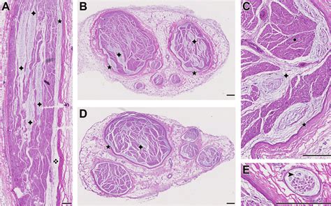 Sciatic Nerve A Longitudinal Section With 4 Rbs Ł In The Download Scientific Diagram