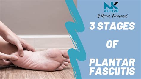 Plantar Fasciitis 3 Possible Stages YouTube