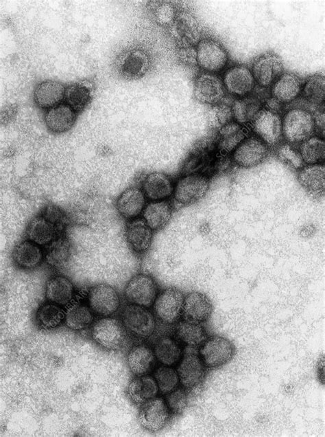 Tick Borne Encephalitis Virus Stock Image M0500259 Science Photo