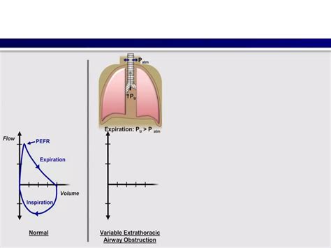Interpretation Of Pulmonary Function Test PPTX Lung And Respiratory Health Diseases And