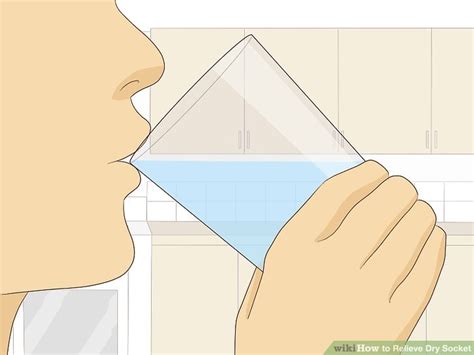 Ways To Relieve Dry Socket WikiHow