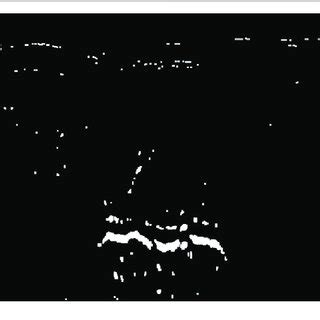 Binary Image After Dilation Processing Download Scientific Diagram
