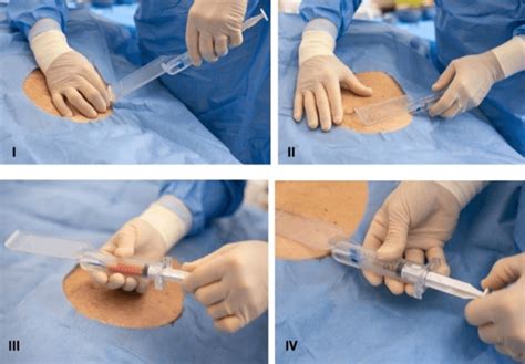 Comparison Of Harvesting And Processing Technique For Adipose Tissue