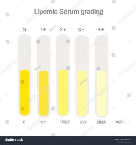 Transparent Cholesterol Index Royalty Free Images Stock Photos Pictures Shutterstock