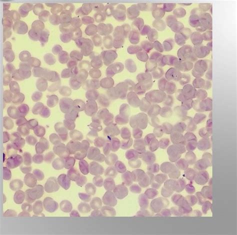 Blood Histo Lab Flashcards Quizlet