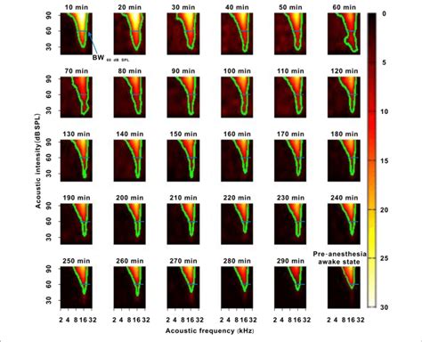 A Representative Neuron With A Change In Frequency Tuning The Download Scientific