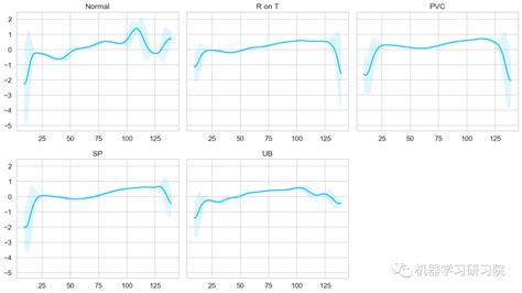 在pytorch中使用 Lstm 自动编码器进行时间序列异常检测 Csdn博客