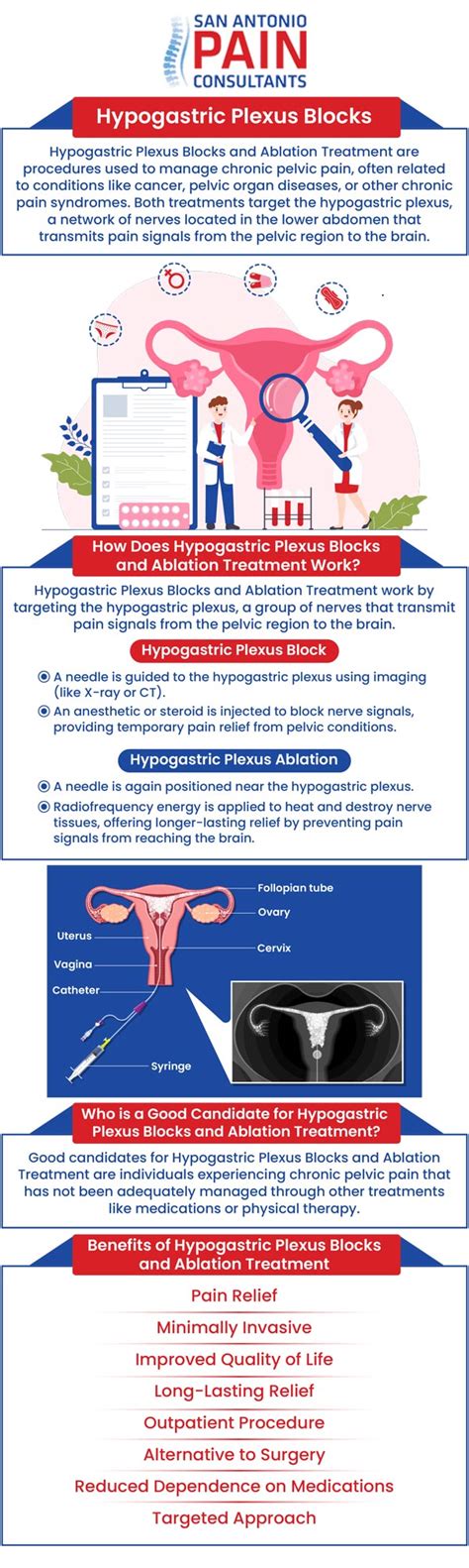 Hypogastric Plexus Blocks And Ablation Treatment Near Me