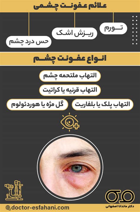 عفونت چشم دکتر ماندانا اصفهانی