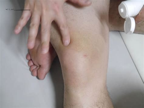 아나파 미세전류 무릎보호대 사용후기 네이버 블로그