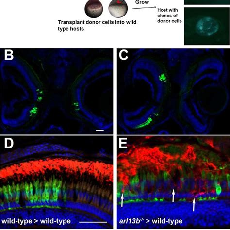 Ultrastructural Analysis Of Photoreceptor Connecting Cilia By