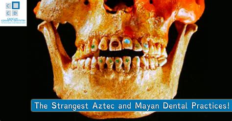 The 3 Strangest Cosmetic Dentistry Practices On Pre Hispanic Cultures