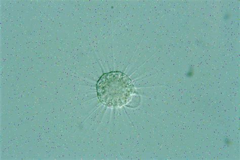 An Example Of Different Noisy Em Images Using Emds 5 Images Download