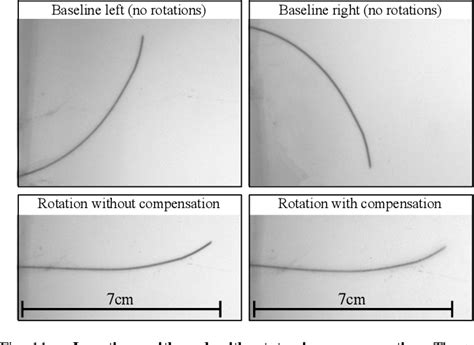 Figure From Modeling And Control Of Needles With Torsional Friction