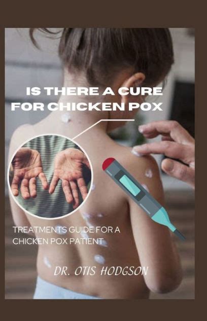 Is There A Cure For Chicken Pox Treatments Guide For A Chicken Pox
