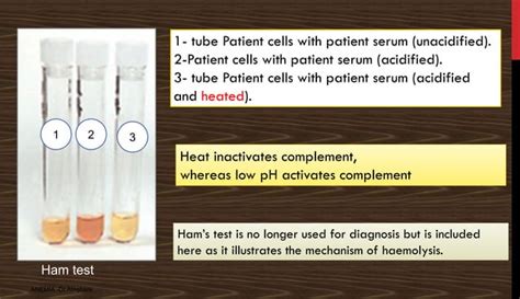 Paroxysmal Nocturnal Hemoglobinuria Pnh Ppt