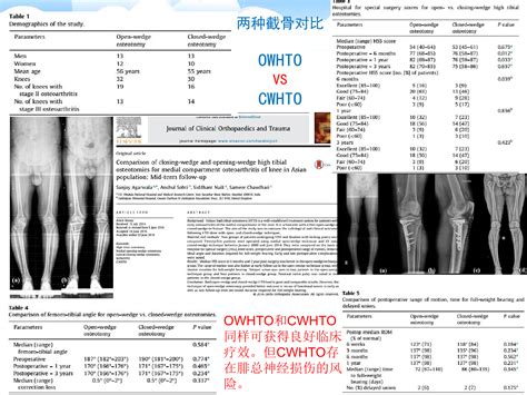 内固定 两种截骨方式比较 胫骨高位截骨术 胫骨内侧开放楔形撑开截骨OWHTO与外侧闭合楔形截骨CWHTO 知乎