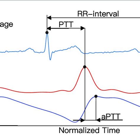 calculation methods of appt arteriolar pulse transit time and ptt