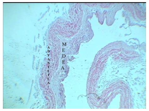 Vascular Ppt