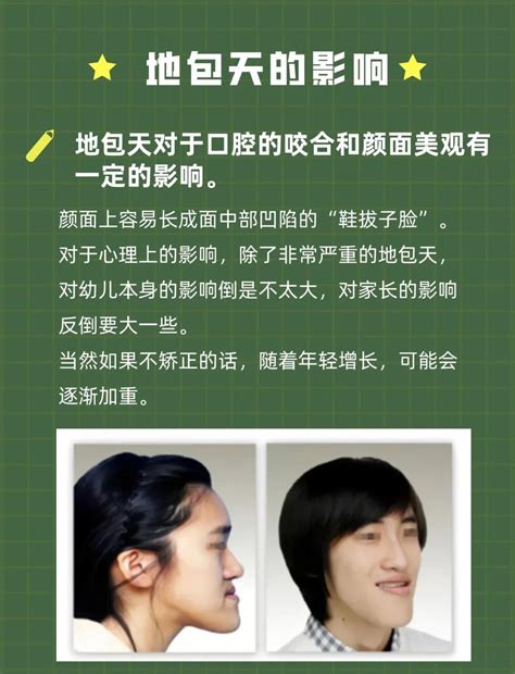 儿童反颌的那些事儿：原因、矫正时机