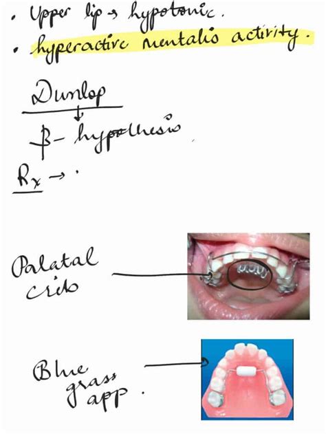 Orthodontics Complete Notes Made Easy Extooth