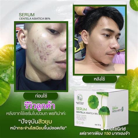 เซรั่มใบบัวบกพรทิน่า Line Shopping