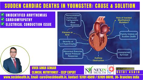 Understanding Sudden Cardiac Death In Young Adults Prevention And Risk