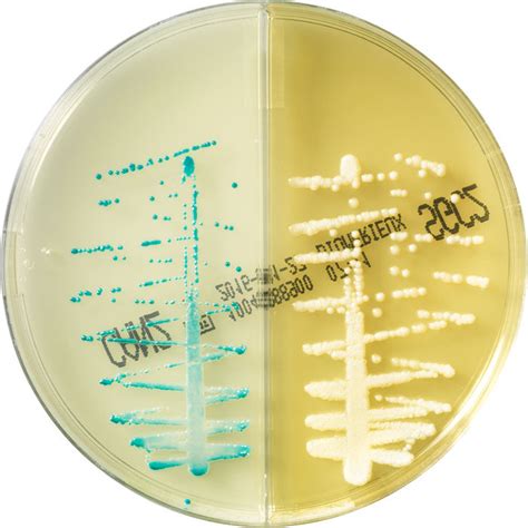 chromID Candida Sabouraud Gentamicine Chloramphénicol 2 Diagnostic