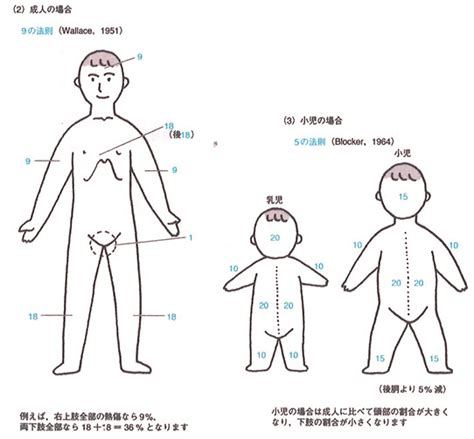 熱傷 塩筑医師会
