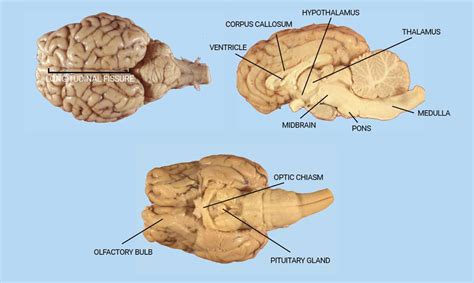 Sheep Brain Anatomy Diagram Dissecting Sheep Brains With Sixth Graders
