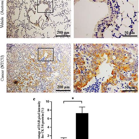 Ntcu Induces Lung Scc Through Download Scientific Diagram