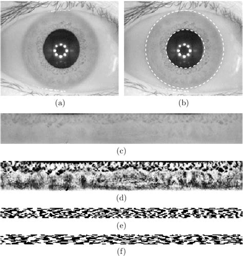 preprocessing and feature extraction a image of eye b detection of