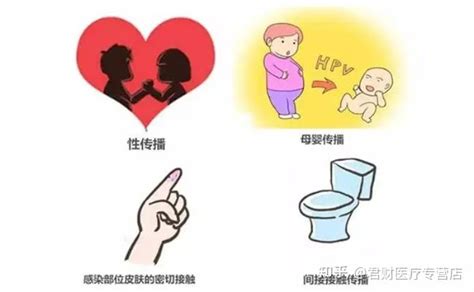 hpv是怎么感染上的有什么症状感染了hpv病毒怎么治疗 知乎