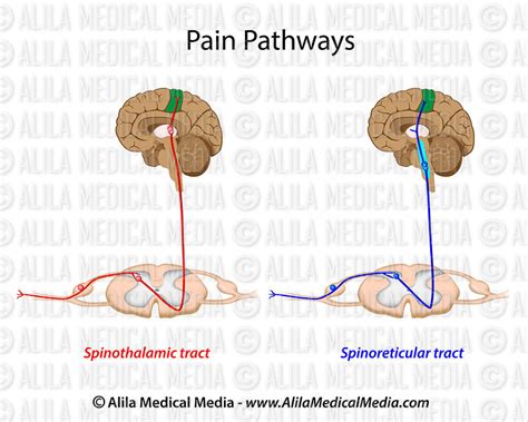 Spinoreticular Tract